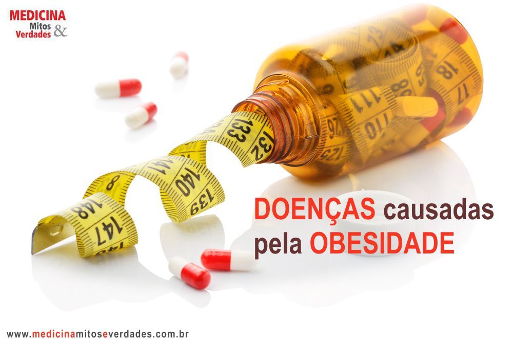 Quando uma pessoa é considerada obesa | Medicina - Mitos e Verdades Quando uma pessoa é considerada obesa | Medicina - Mitos e Verdades